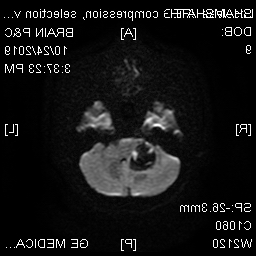 NSC MRI Object Detection Dataset by wtnny
