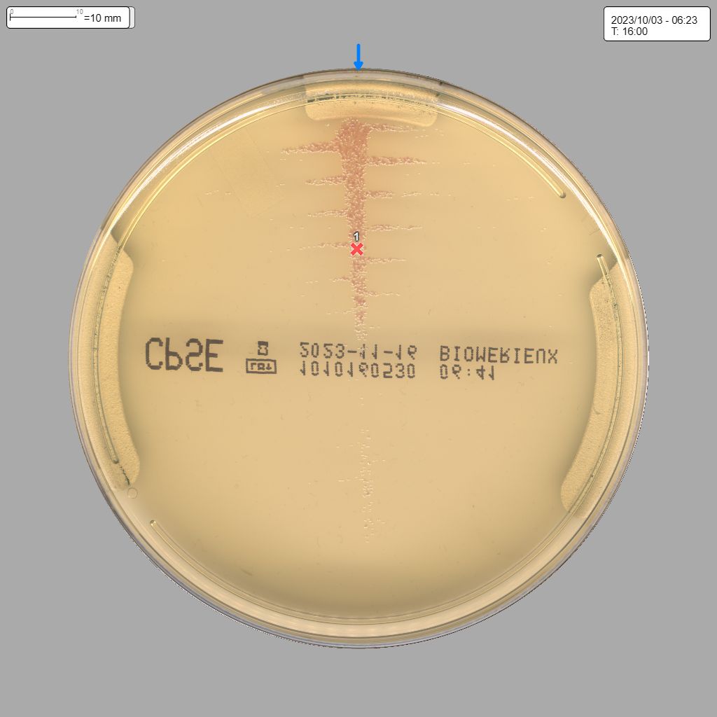3classbacteria Object Detection Dataset By Medeniyet Universty
