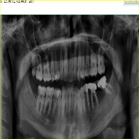 vzrad2 Instance Segmentation Dataset by Arshs Workspace Radio