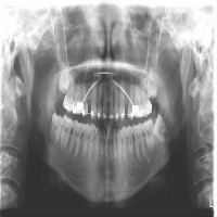 vzrad2 Instance Segmentation Dataset by Arshs Workspace Radio