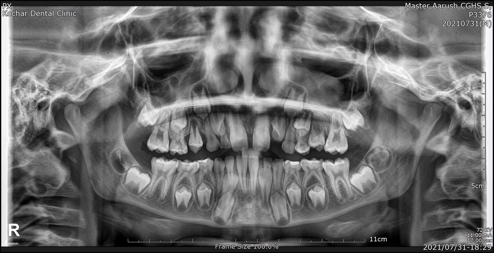 vzrad2 Instance Segmentation Dataset by Arshs Workspace Radio