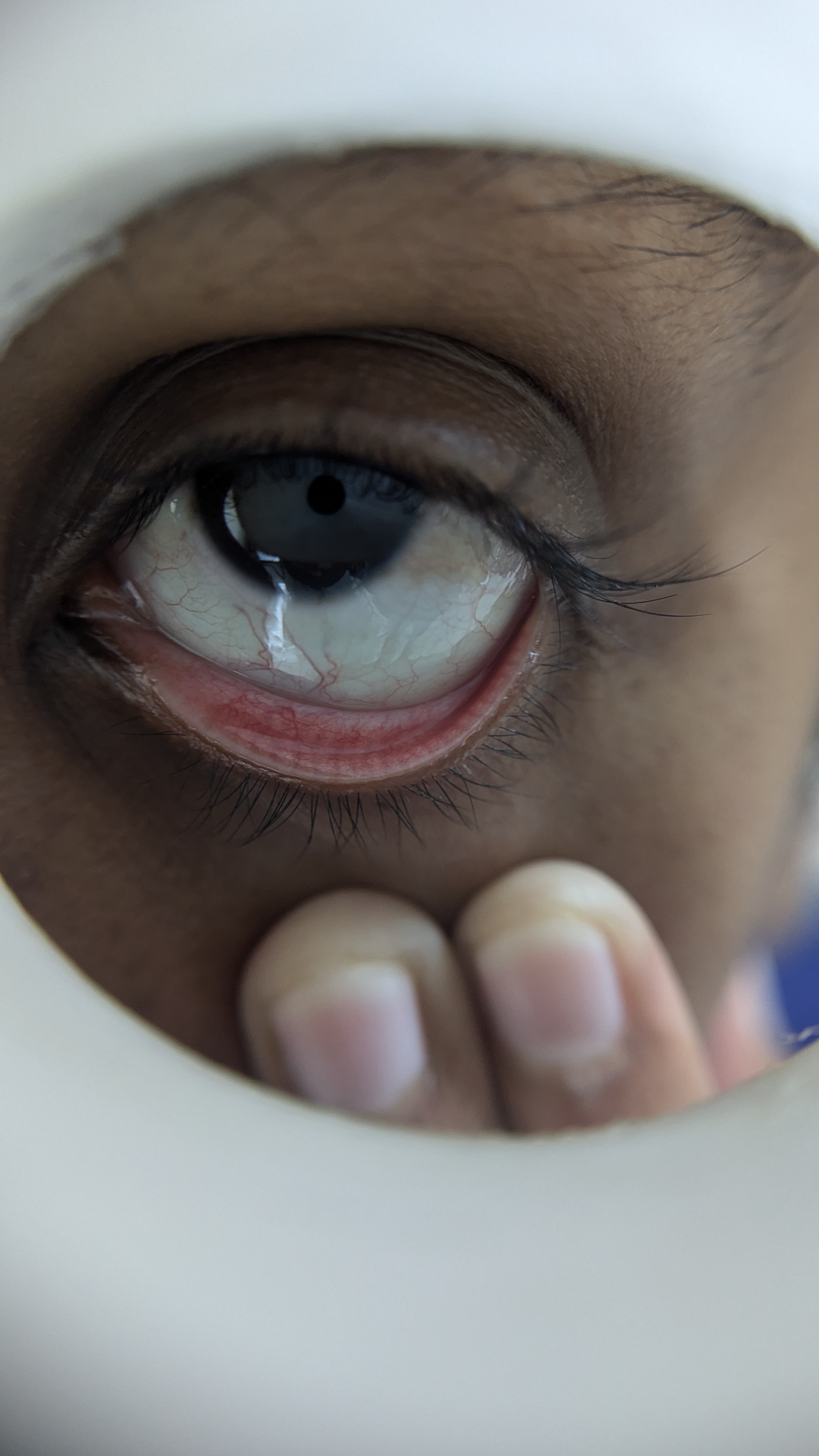 How to Use the Non Invasive Anemia detection Object Detection API