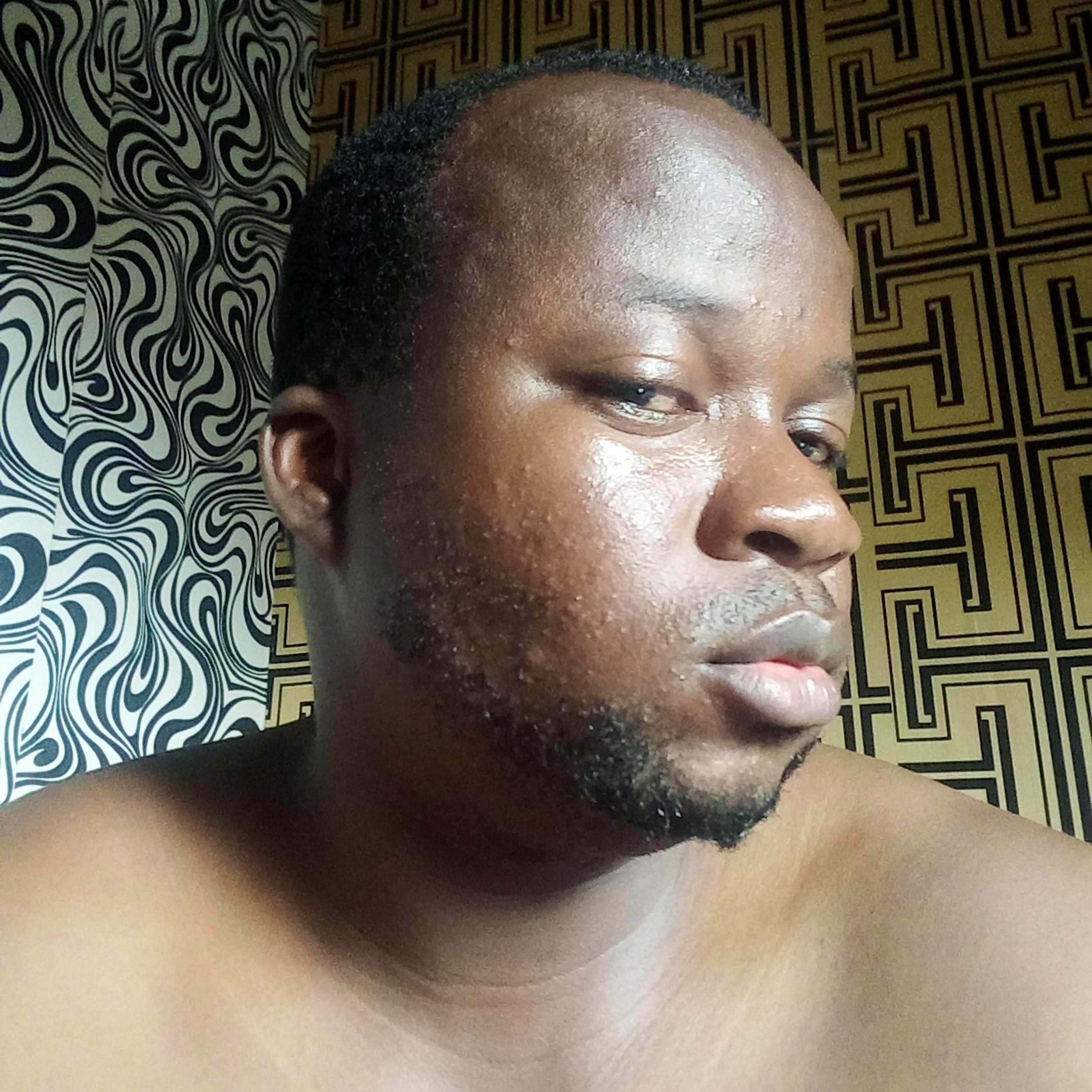 Skin Problem Detection Multiple Clean Object Detection Dataset V2 2023 12 26 6 40am By Parin