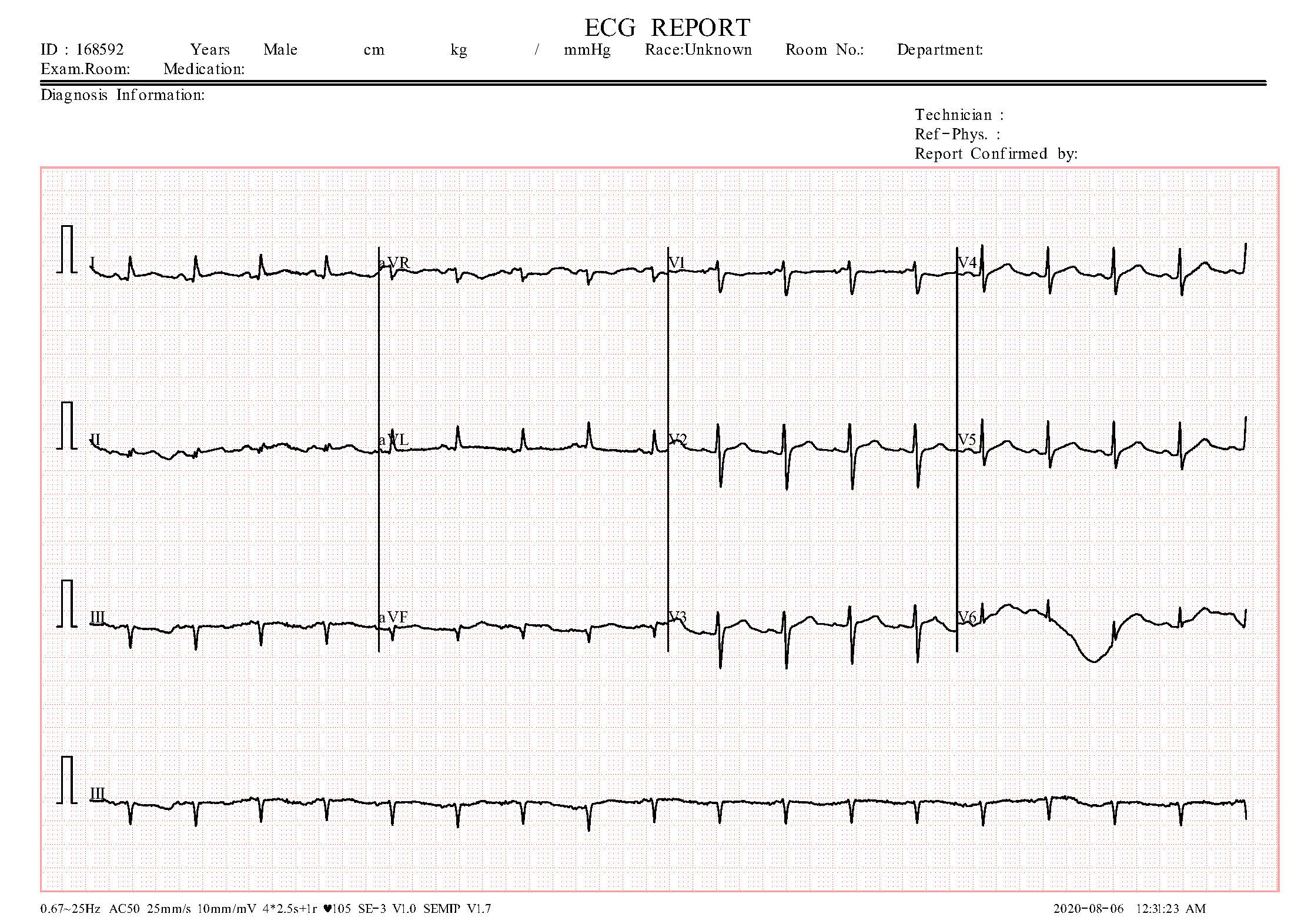 ECG-Disease-Classification Classification Dataset and Pre-Trained Model by Inatel
