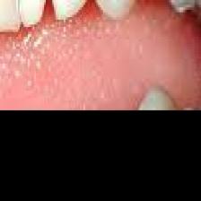 caries Object Detection Dataset and Pre-Trained Model by Gurpreetbpgcbgmailcom