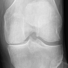 bone Instance Segmentation Dataset by bone
