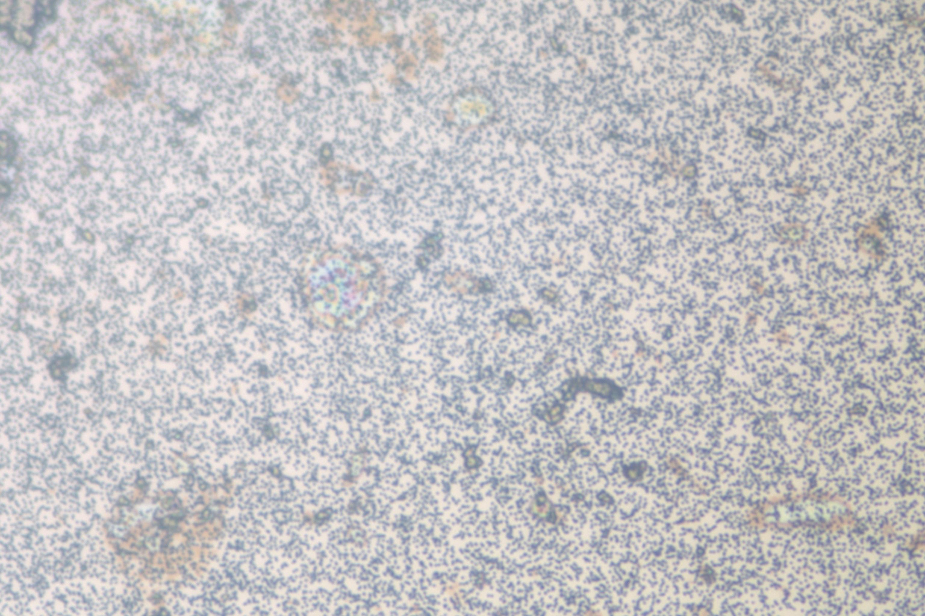 particles Instance Segmentation Dataset and Pre-Trained Model by yoloparticle