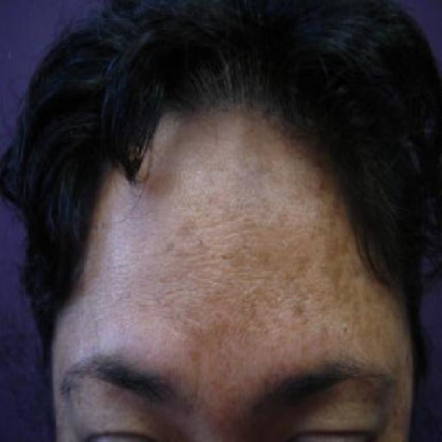 How to Use the dark spots Instance Segmentation API