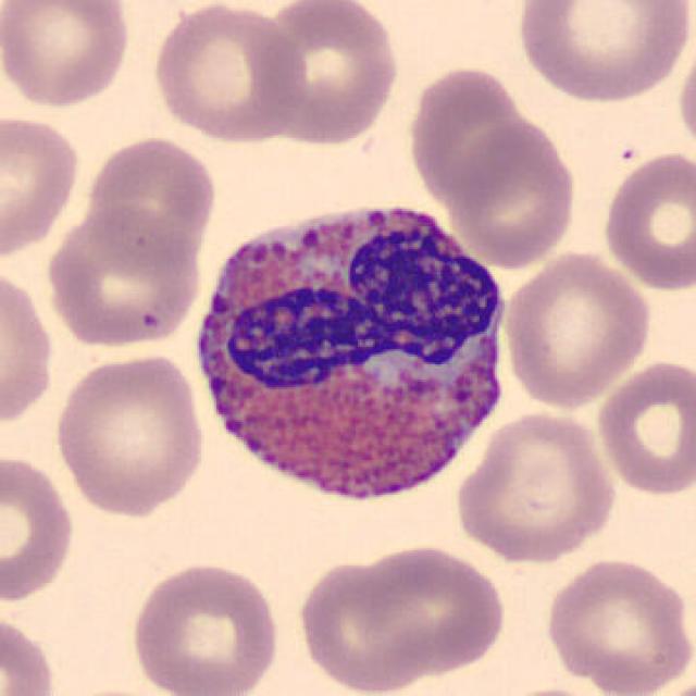 7 type Blood Cell Object Detection Dataset by Long Cam