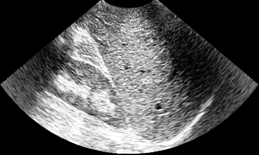 Kidney-Liver Segmentation Dataset and Pre-Trained Model by Disertatie