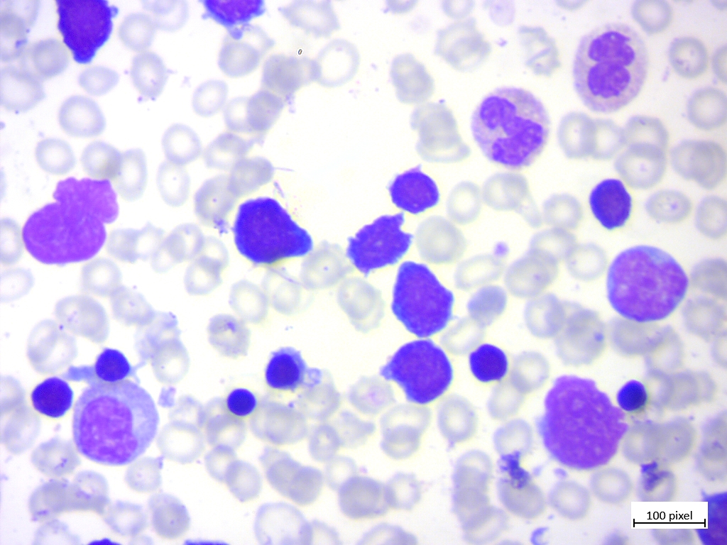 Count the number of blood cells Object Detection Dataset by YOLO