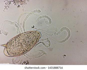 bacteria detection Object Detection Model by Rithul