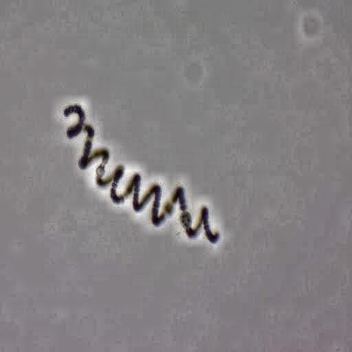 Watern-born Bacteria Object Detection Model by Rithul