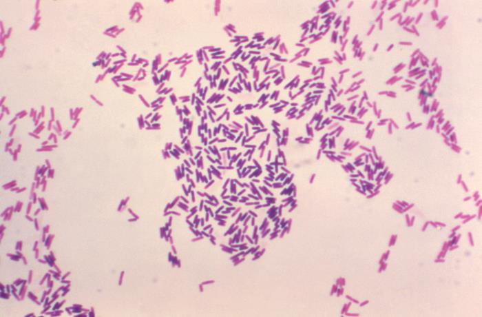 Bacteria Dataset Object Detection Dataset by Rithul