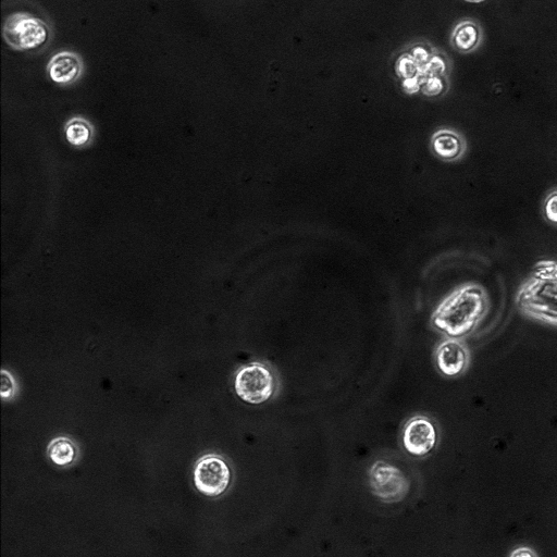new_microalgae_copper_ions_NPs Object Detection Model by Algae