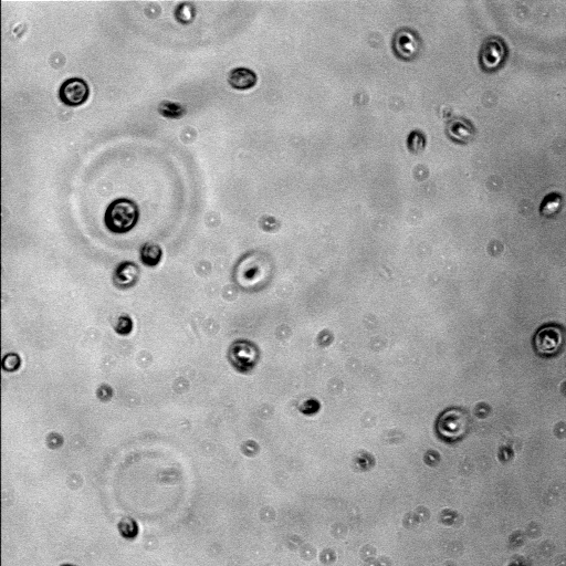 Project_micro_algae Object Detection Dataset by Algae