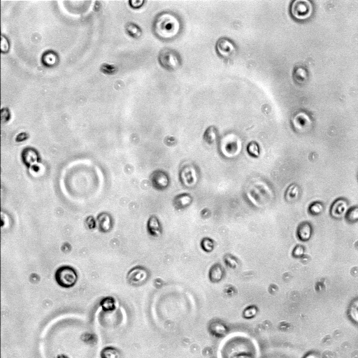 hurray Object Detection Dataset by Algae