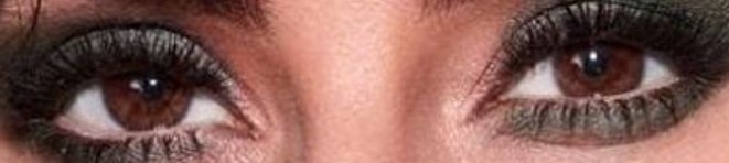 open&clinicalupto6feb Object Detection Dataset by Strabismus