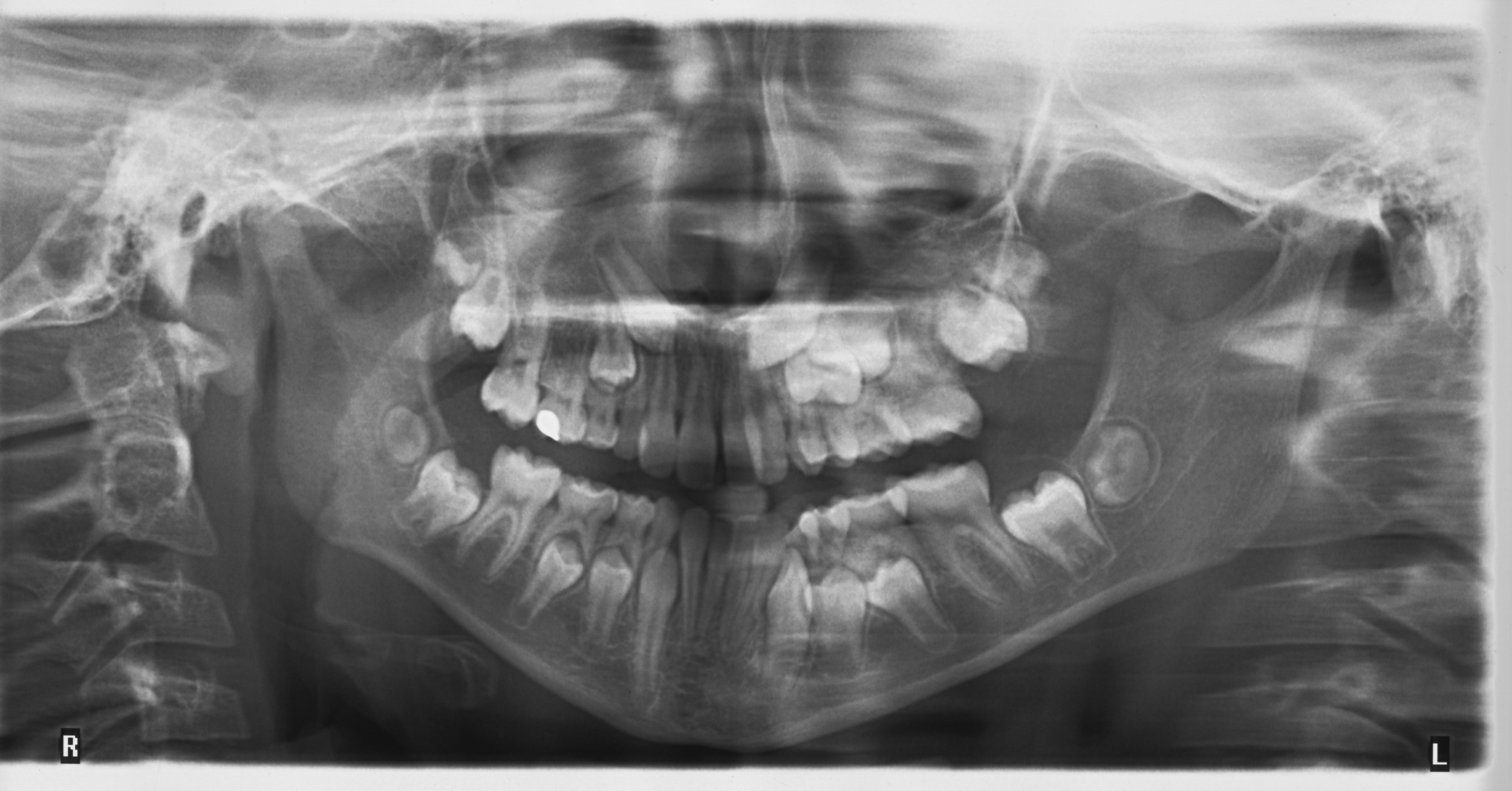 Dientes dientes o1vmd Roboflow Universe dientes-dientes-o1vmd-roboflow-universe