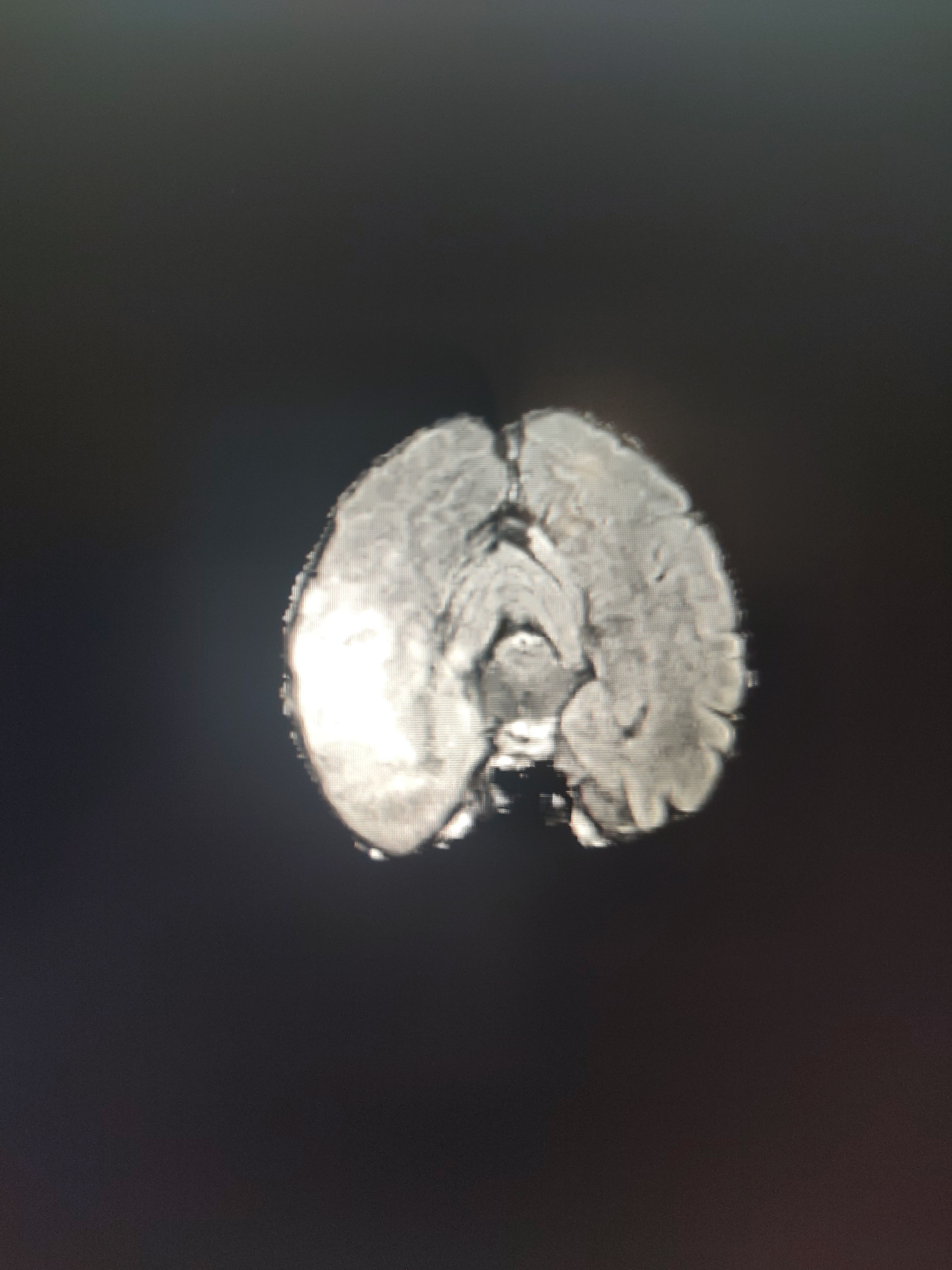 brains_detection_bad_photos Object Detection Model by brainimages