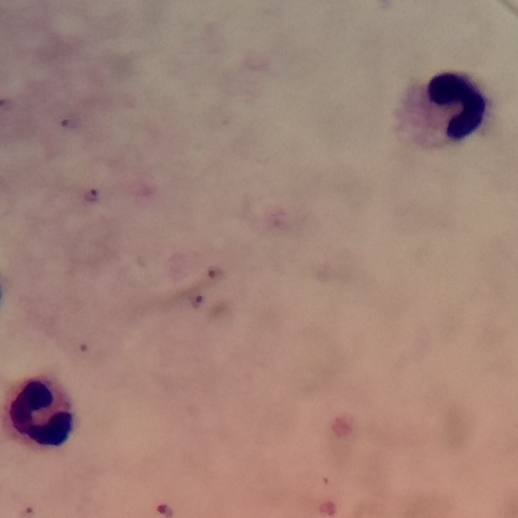 Malaria Detection Object Detection Dataset By Malariaparasitedetection