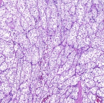 Soft Tissue Histopathology Classification Classification Model by Soft ...