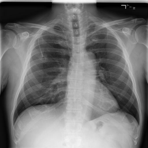 TB by Sextant OD Object Detection Dataset and Pre-Trained Model by KBS
