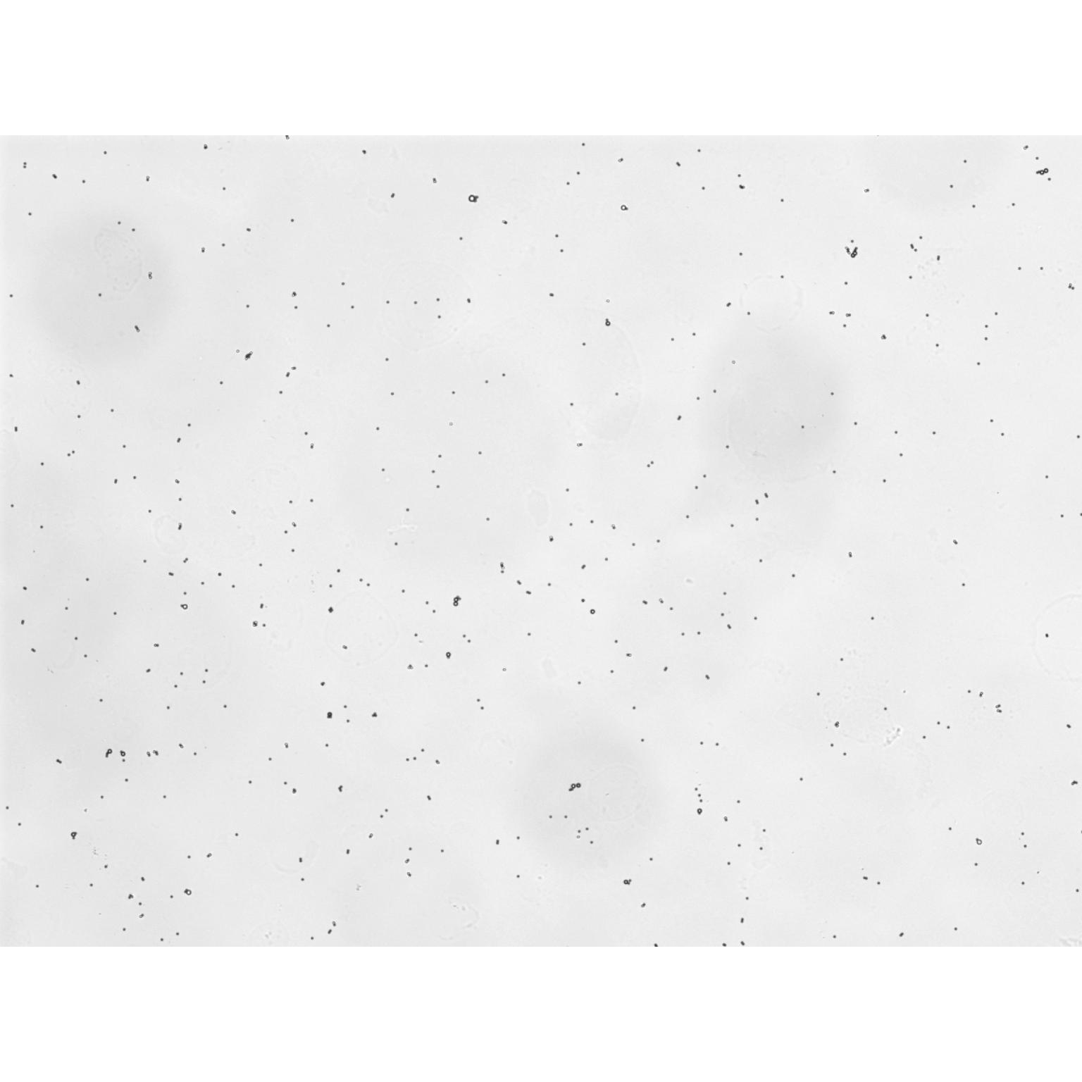 Custom Revise Object Detection Dataset And Pre Trained Model By Retina