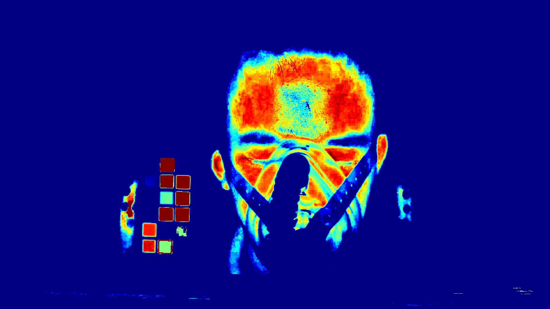 Forehead Heatmap Segmentation Instance Segmentation Model by project-0fmyo