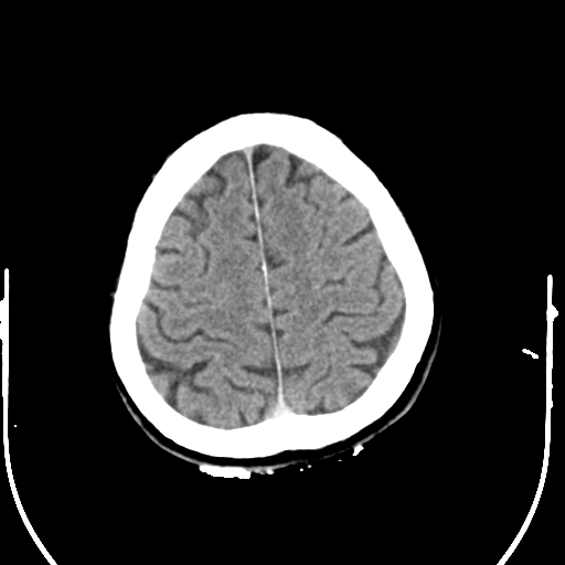 brian strom - Roboflow Universe