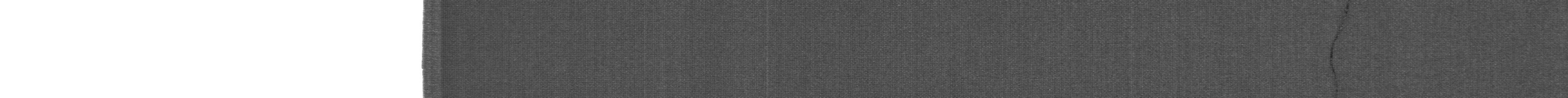 Fabric Defect Detection Classification Dataset By Workspace1