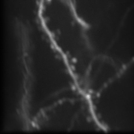 Dendritic Spines Dclassification Object Detection Dataset By Dendrite Spines Classification