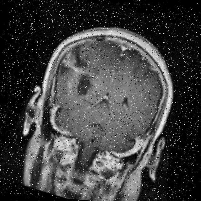Alzheimer Detection Synapse Object Detection Model (v2, 2024-04-19 5 ...