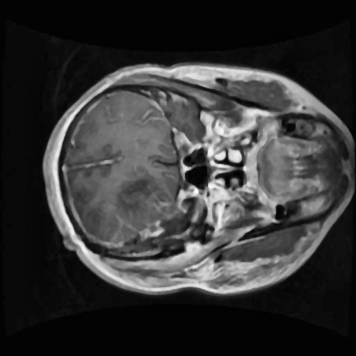 Median Histogram Object Detection Dataset And Pre Trained Model By Median Histo