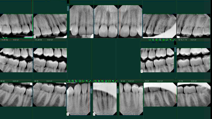 xray_teeth labels Object Detection Dataset by hassaan