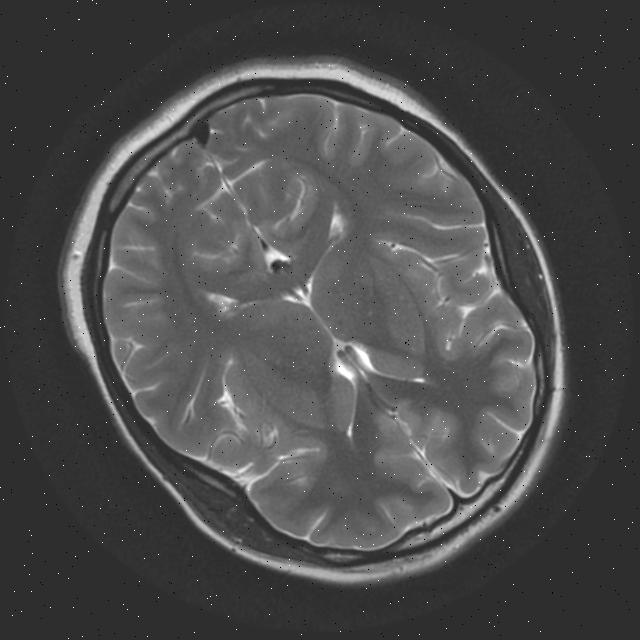 tümör var,yok Object Detection Dataset and Pre-Trained Model by mali
