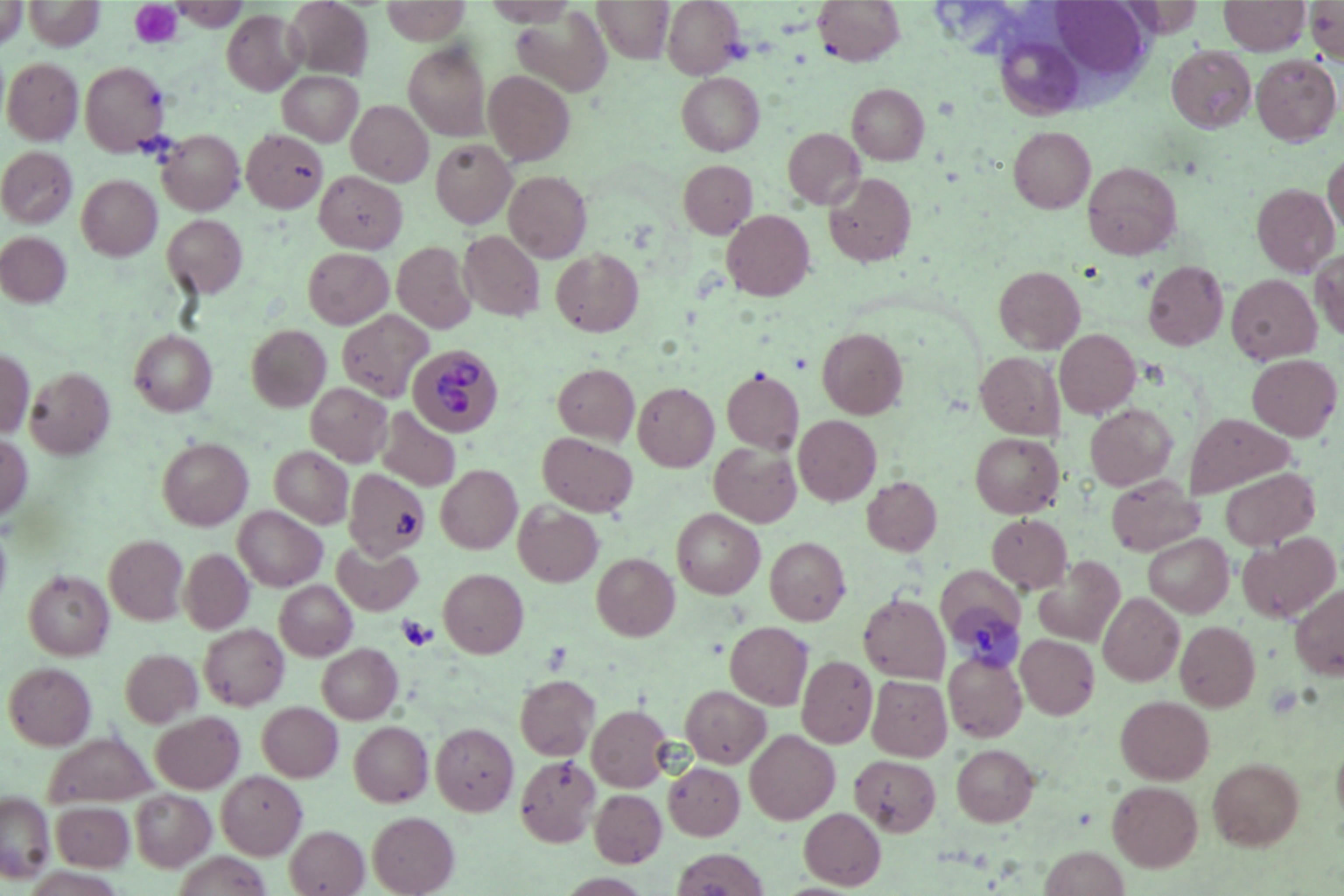 My IA Projects - Roboflow Universe