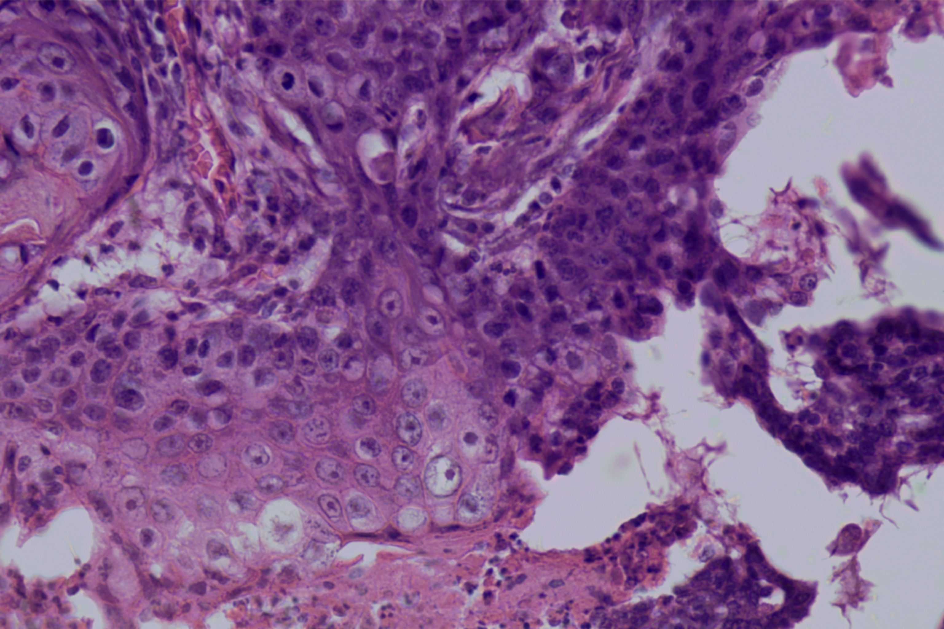 oss Instance Segmentation Dataset by My IA Projects