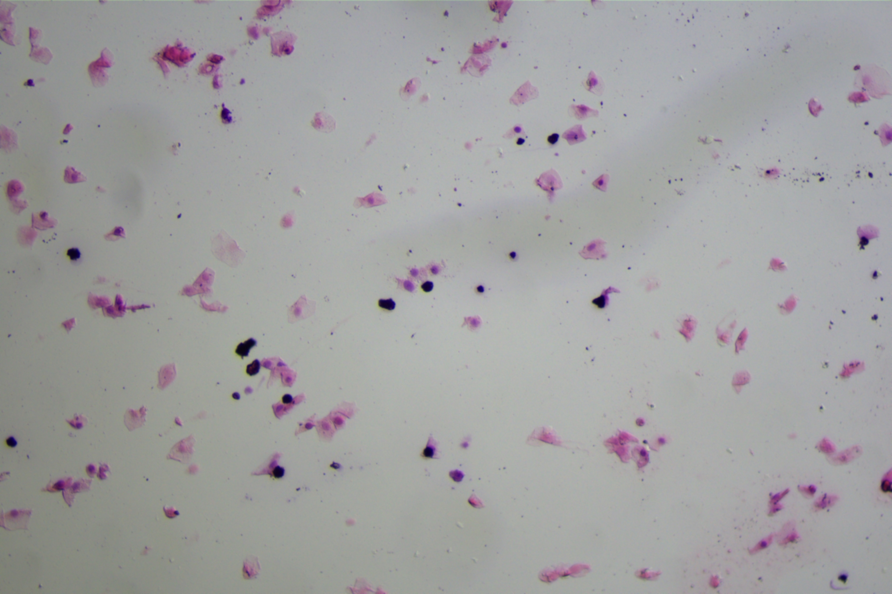 lecu Instance Segmentation Dataset by My IA Projects