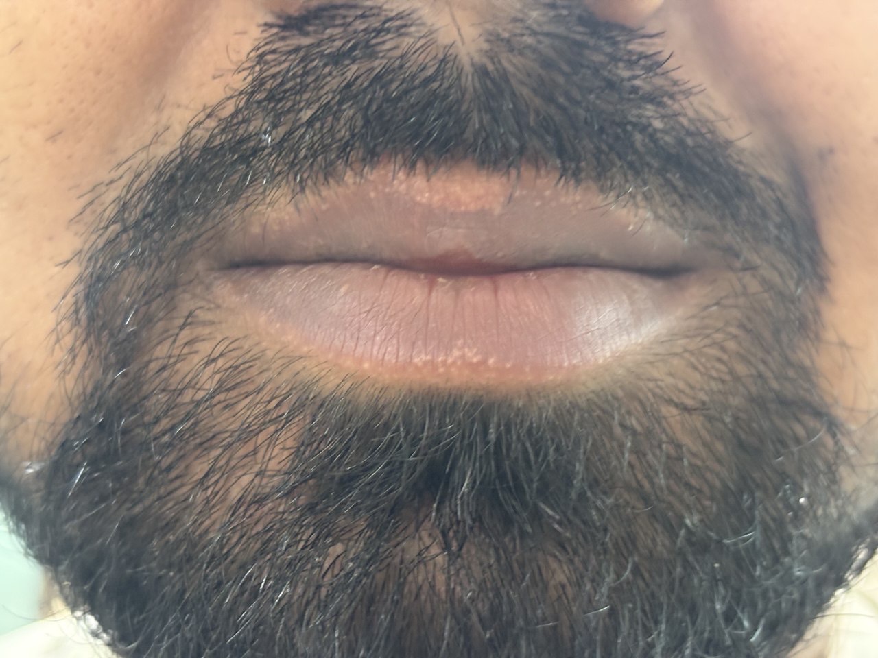 lip Object Detection Model by exp42