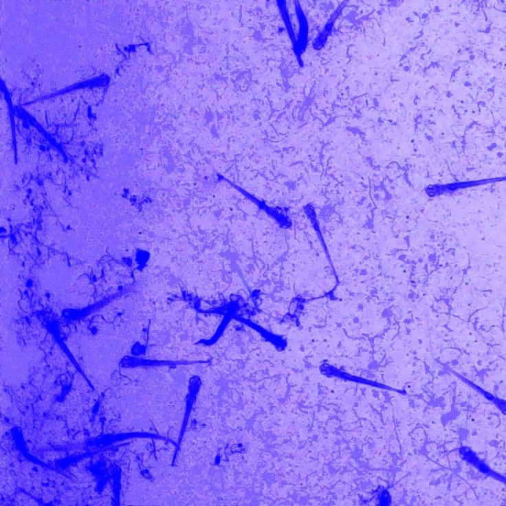 Dt 023 C M Y V2 Is 100 Imgs Instance Segmentation Dataset By Postlarvaslitap