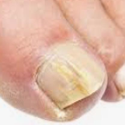 nailsDt1 Object Detection Dataset by test