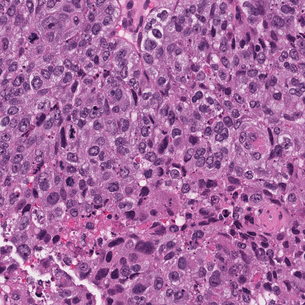 Cell Detection Instance Segmentation Dataset By Cdar 2814