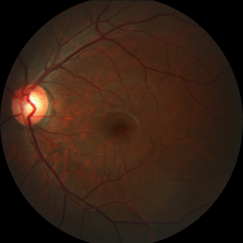 Superprof - Roboflow Universe