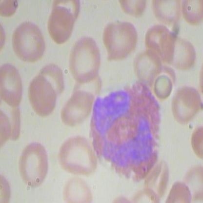 blood-cells-retraining6 Object Detection Dataset by Evan Kiefl