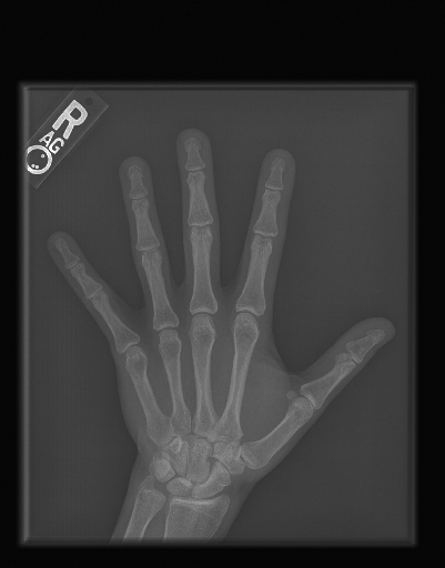 Xray Classification Classification Dataset By Xrayclassifier
