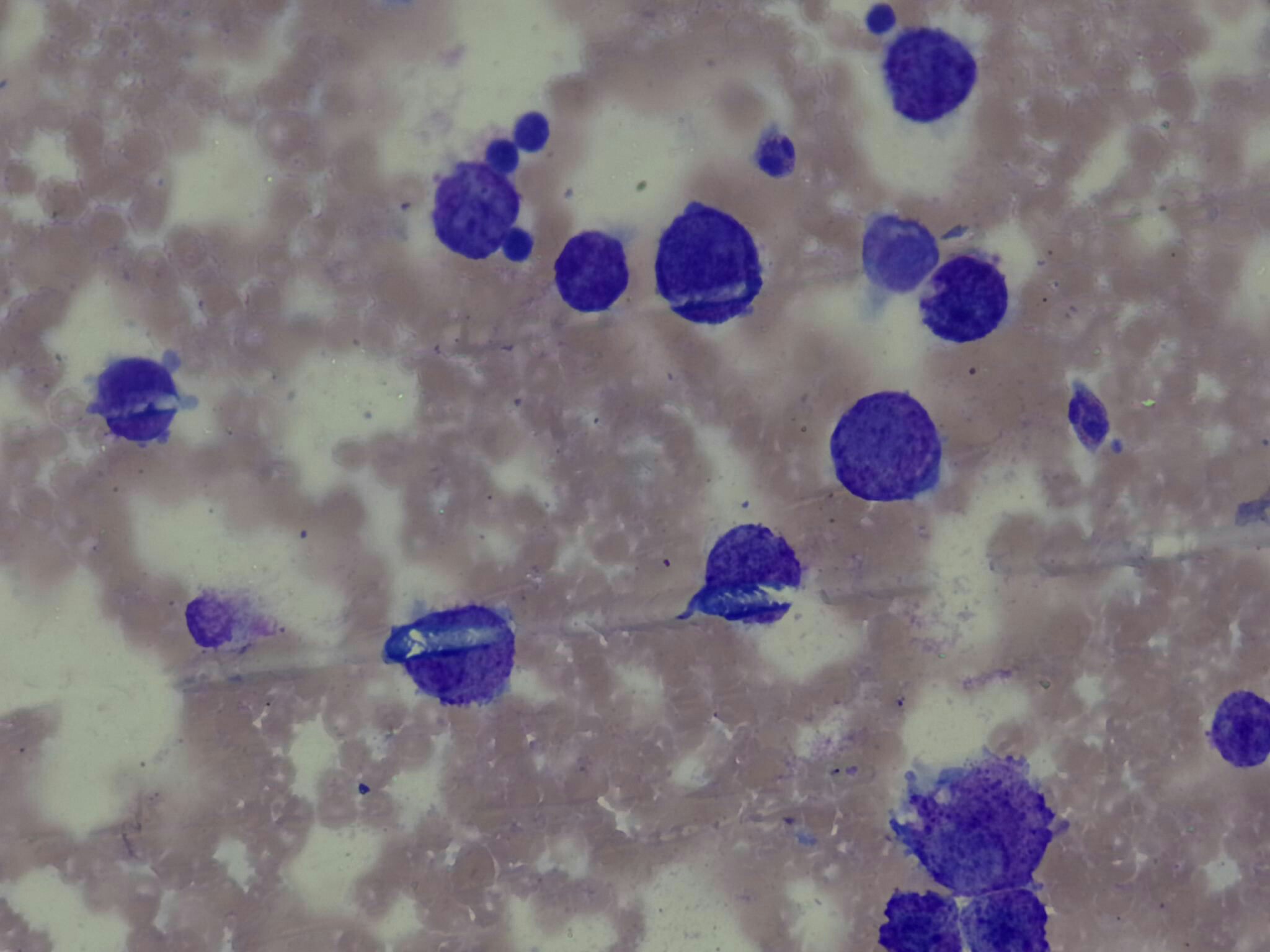 rbc_-mast-cell Instance Segmentation Dataset by Univesity