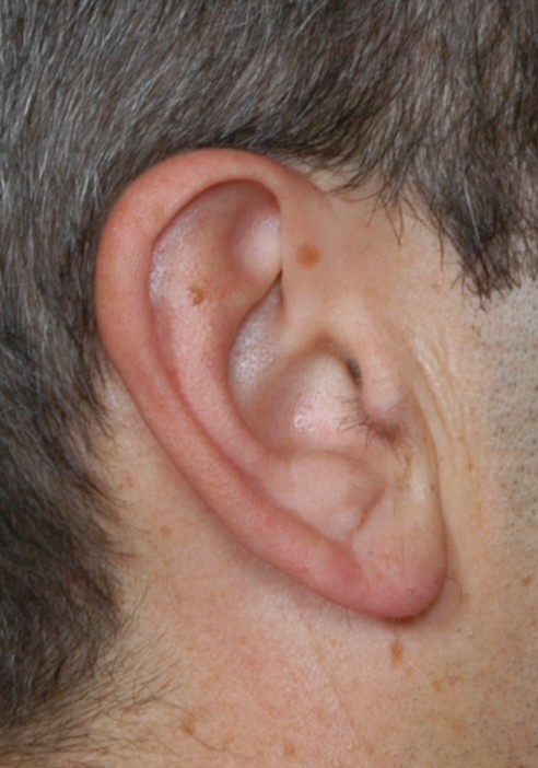 Ear keypoints Instance Segmentation Model by SaifULL