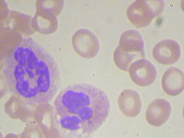 Custom Workflow Object Detection Object Detection Dataset and Pre-Trained Model by cell detection