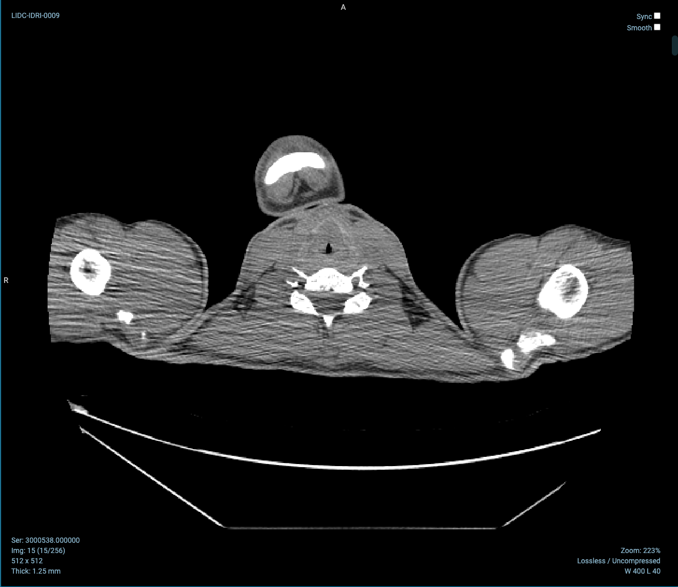 How to Use the CT Scan Structure Identification Instance Segmentation API